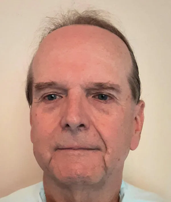 Dr. Greg Watson, Psychology | Portland, OR | WebMD