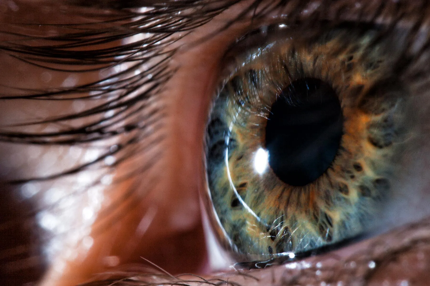 Cornea: Anatomy, Common Symptoms, and Treatments