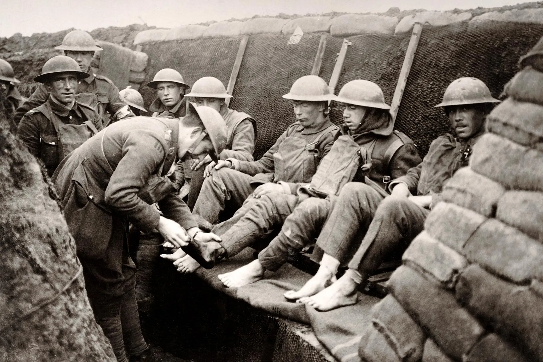 Trench Foot: What It Looks Like and How It’s Treated