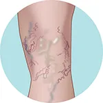 Symptoms of Poor Circulation