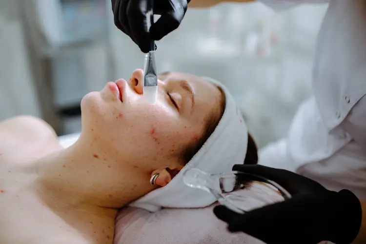 Acne Treatments That Work