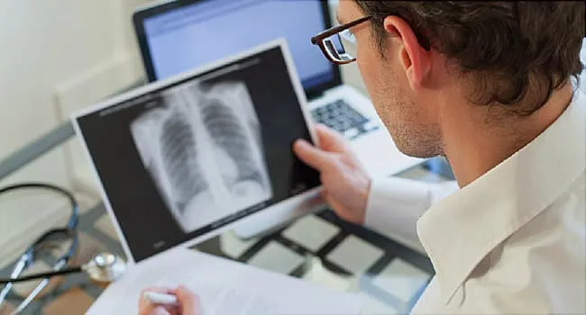 Tests for Pulmonary Arterial Hypertension: Heart, Lung, Blood, and ...