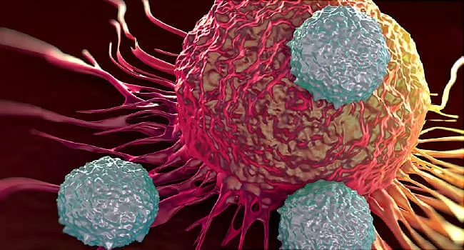 Non-Small-Cell Lung Cancer: Causes, Symptoms, and Treatment