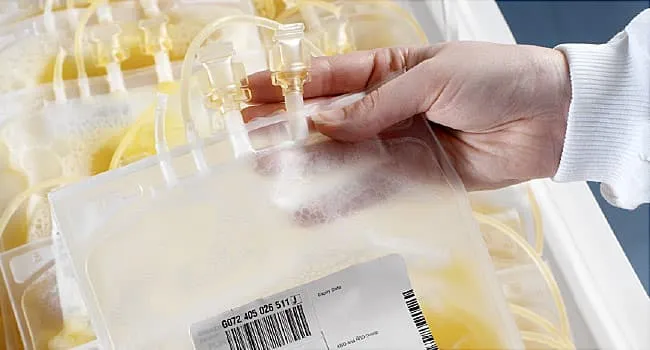 Plasmspheresis: Plasma Exchange for MS