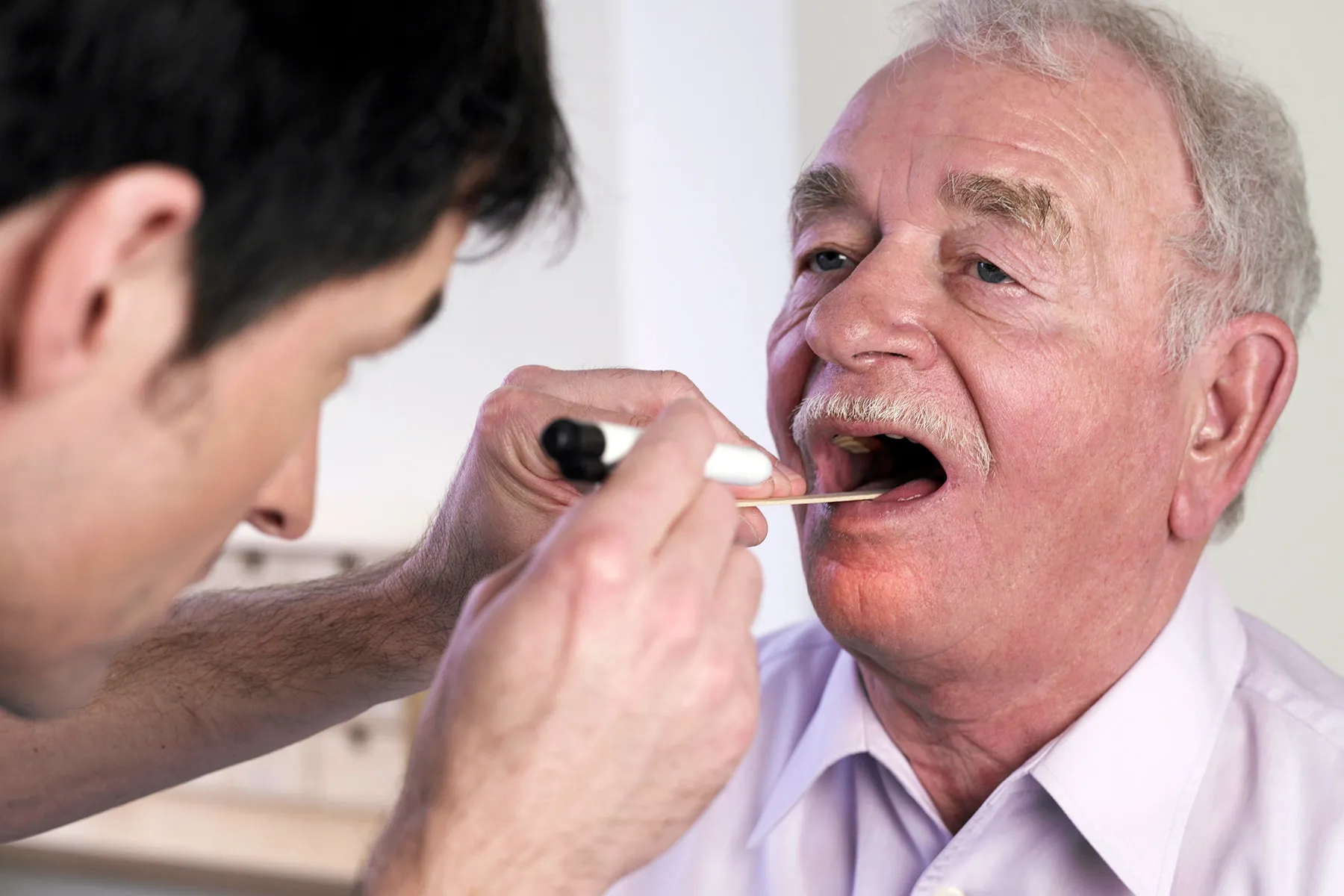 Tonsil Cancer: Symptoms and Treatments