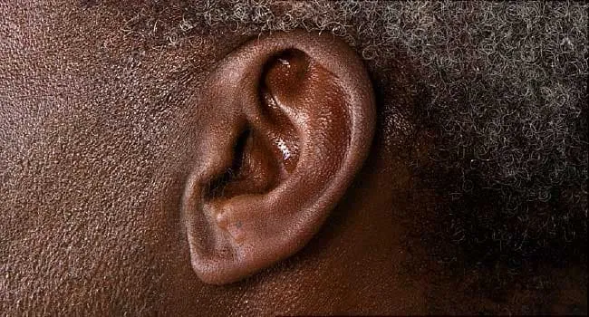 Tinnitus (Ringing in the Ears) Causes and Definition