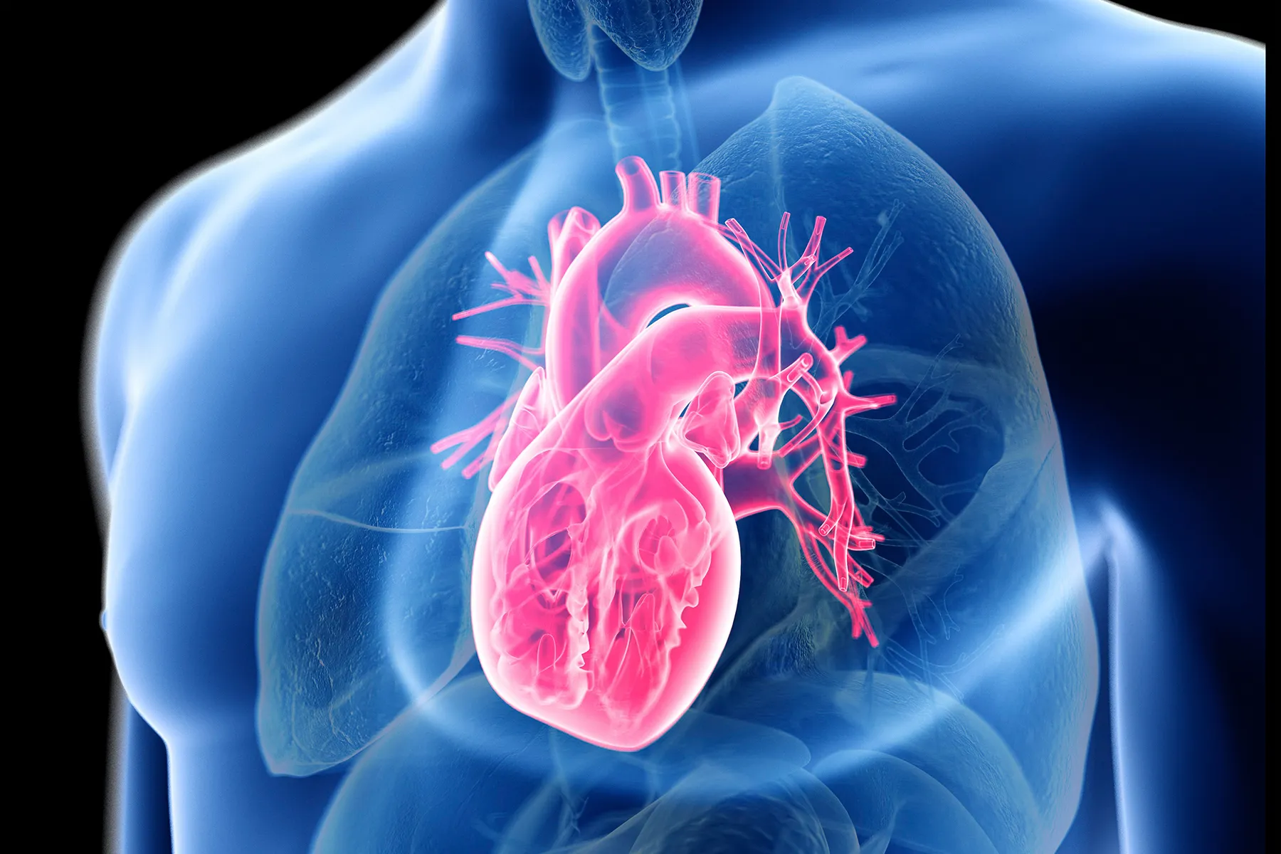 Complications of Atrial Fibrillation