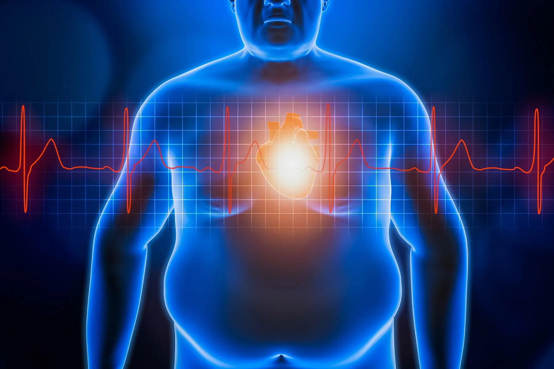 What causes belly fat?