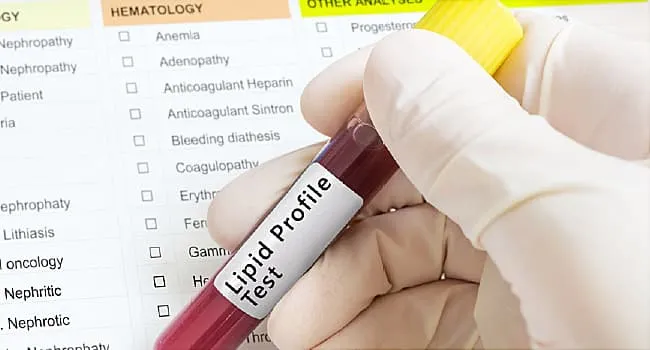 All About Triglycerides Explained