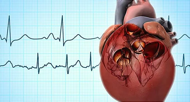 Atrial Fibrillation ECG Test Pictures: Symptoms, Causes, Tests, and More