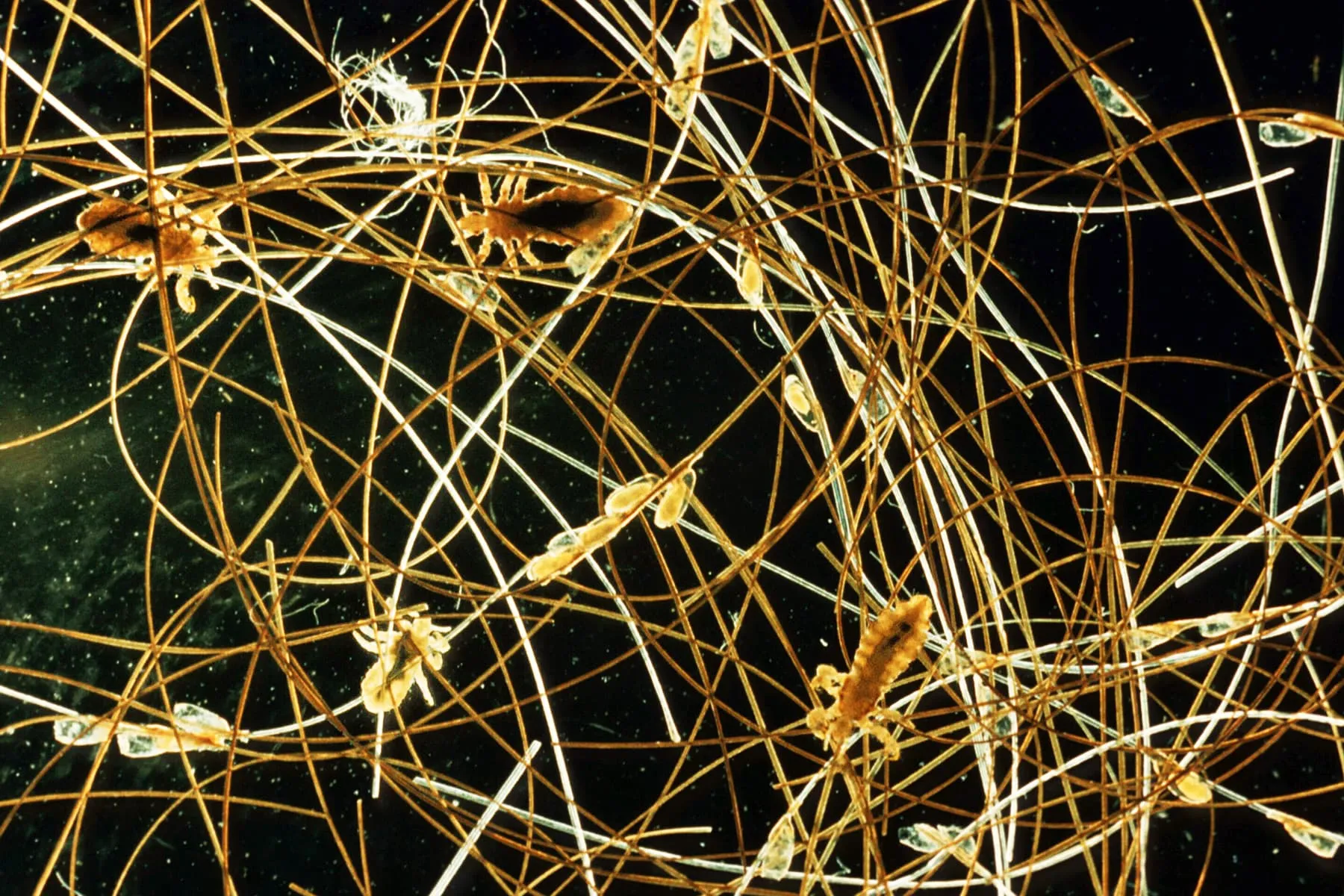 Creatures That Live on Your Body