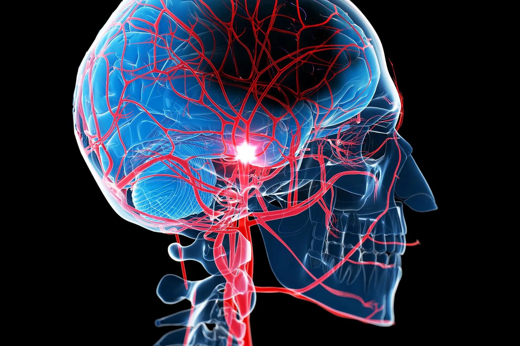 How Migraines Increase Risks for Health Conditions