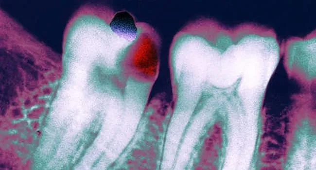 three mouth problems