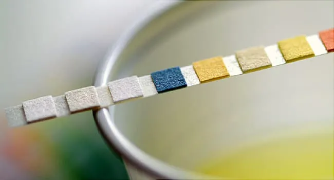 UTI Pictures: Bladder Infection Symptoms, Causes, Home Remedies, and More