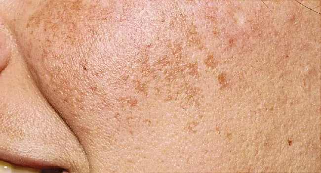 What Does Your Face Say About Your Health?