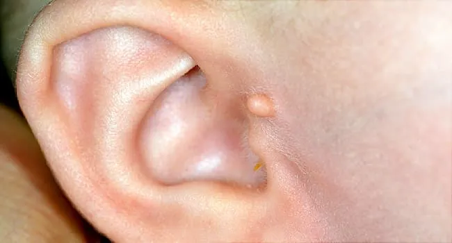 healthy ears