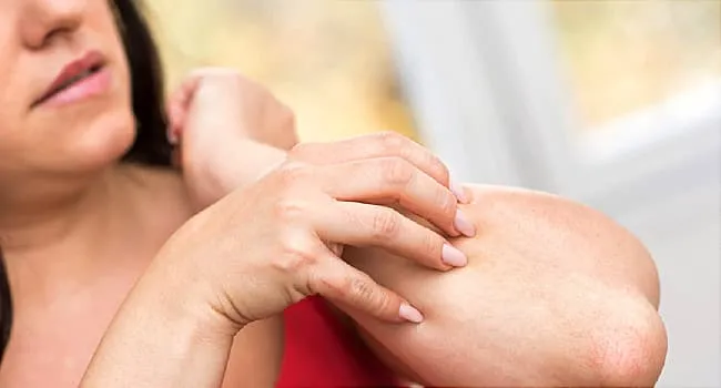 itching like a banshee