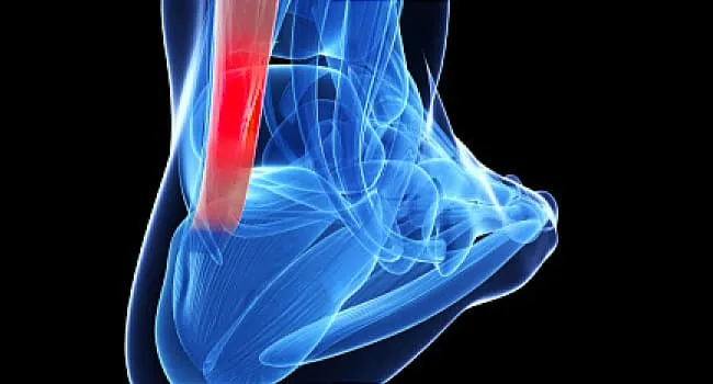 Why Does My Ankle Hurt? 15 Possible Causes of Ankle Pain