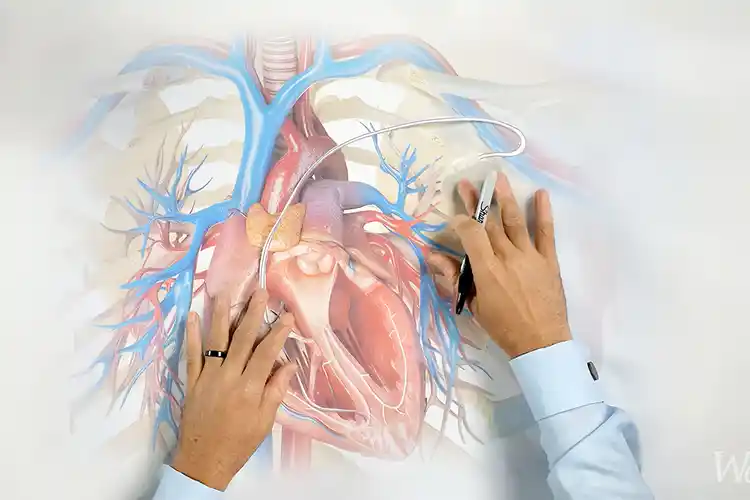 How Treatment Works