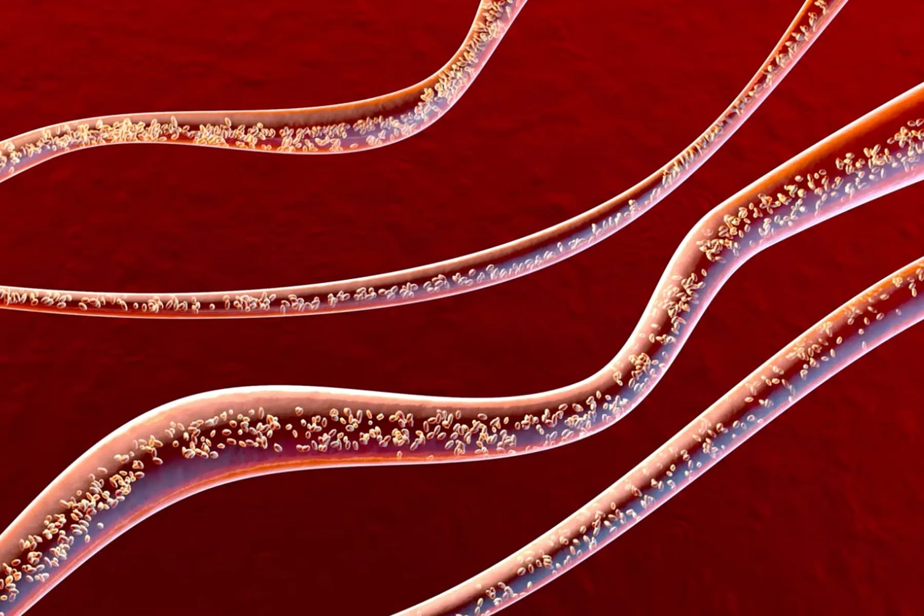 Video on RA: How Injections Work