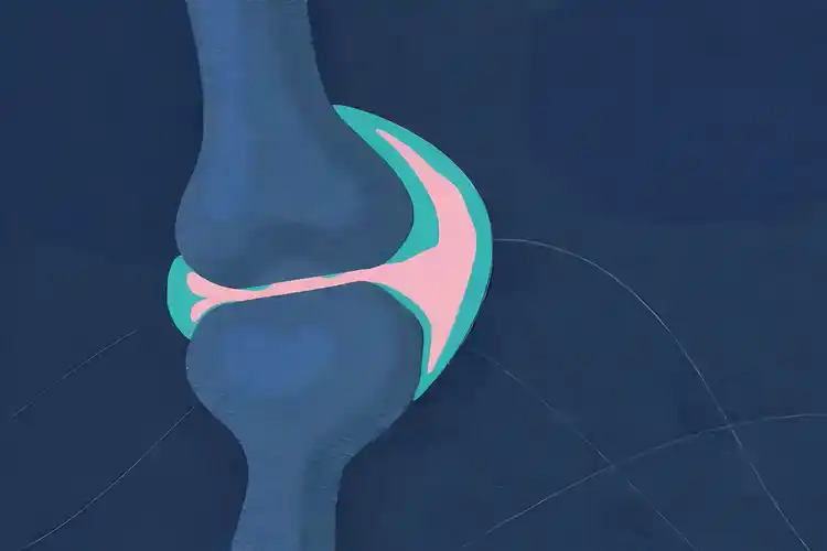 TGCT Types and Treatments