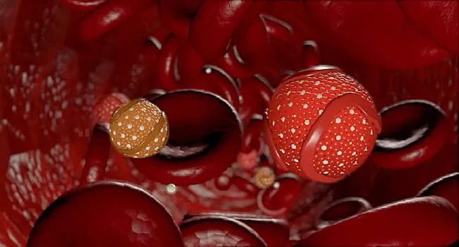 Cholesterol Treatments Video on Ways to Maintain Low LDL Levels