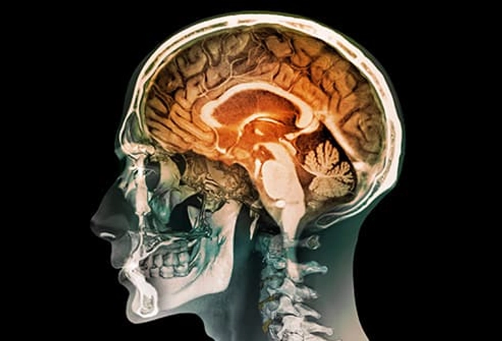 Brain